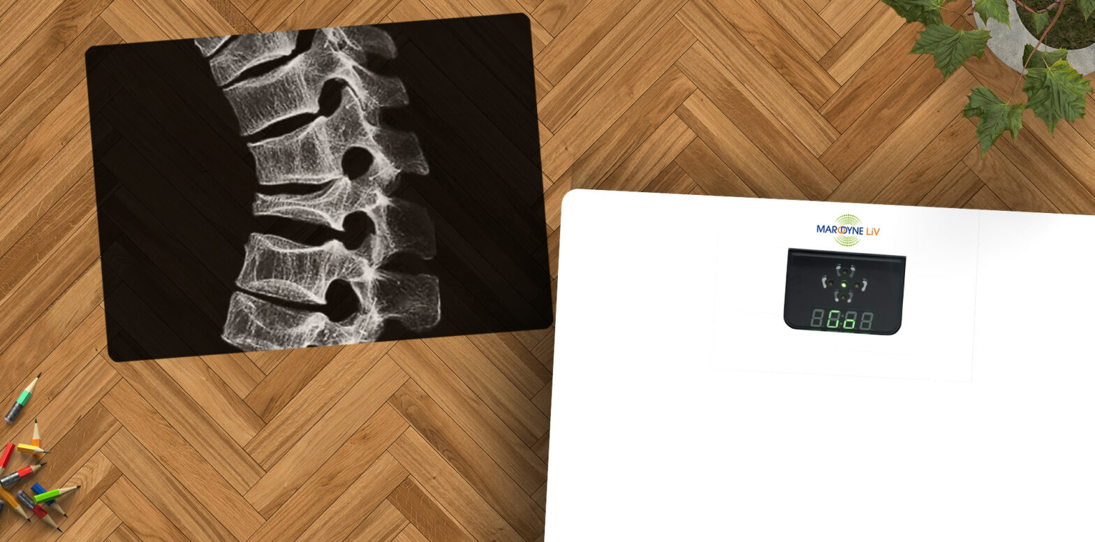 Knochendichte verbessern mit der Vibrationstherapie